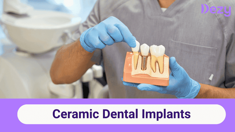 What Are Ceramic Dental Implants?